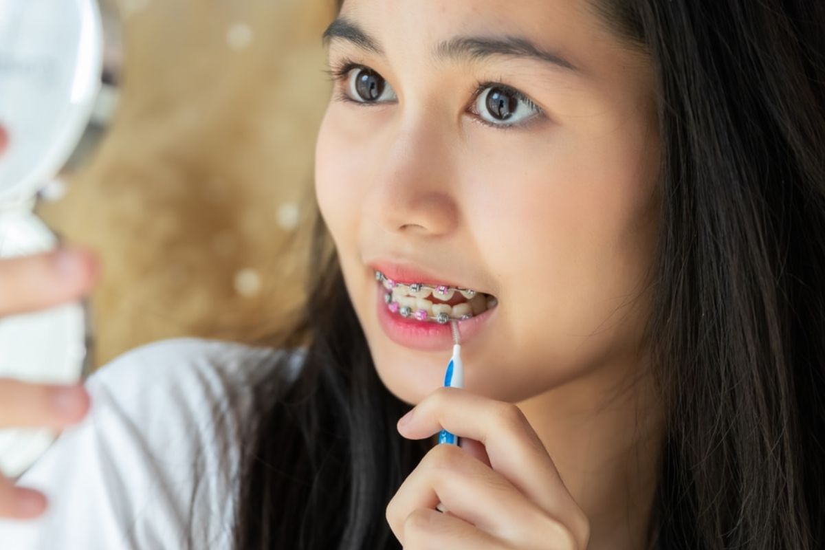 How to Maintain Oral Health with Braces: Tips for a Healthy Smile