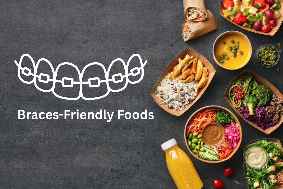 Best Soft Foods to Eat with Braces